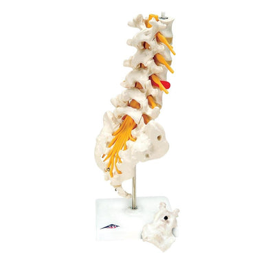 Lumbar Spinal Column Models | Lumbar Vertebrae Models – Tagged "Lumbar ...