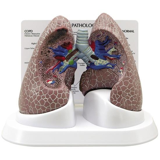 Lung Set Model with Pathologies – GTSimulators.com