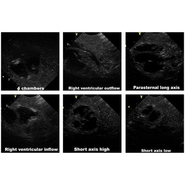 Newborn Torso for X-Ray CT and Ultrasound – GTSimulators.com