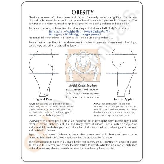 Obesity Model with Education Card – GTSimulators.com
