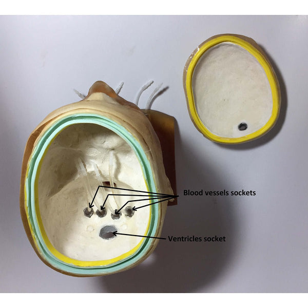 Openable Adult Head Phantom for X-Ray CT, Ultrasound and MRI ...