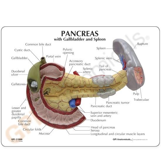 Pancreatic Cancer, Gallbladder w- Stones & Duodenal Ulcer Model ...
