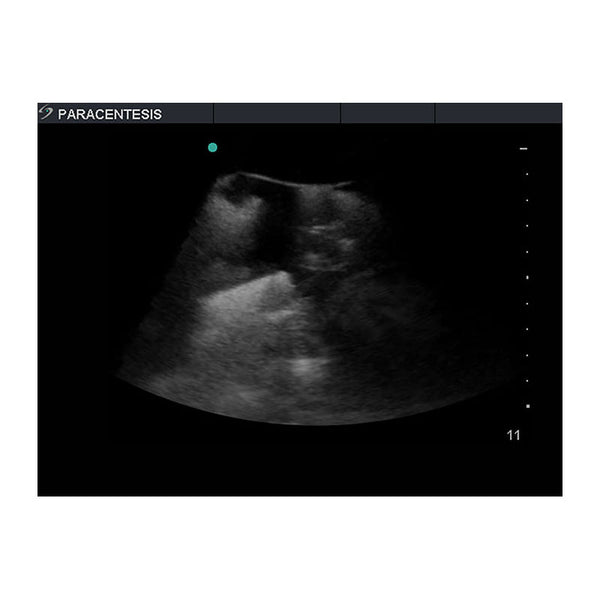 Paracentesis Ultrasound Training Model – GTSimulators.com