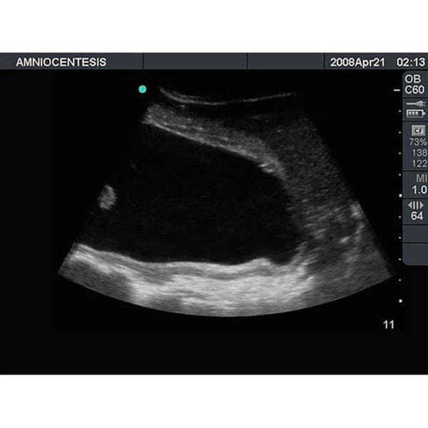 Percutaneous Umbilical Cord Blood Sampling Ultrasound – GTSimulators.com