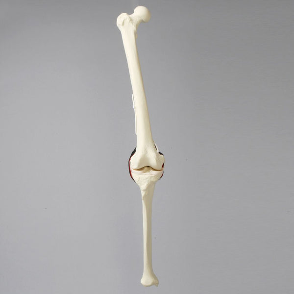 Replacement Knee Insert, Encapsulated ACL with Adjustable Ligament ...