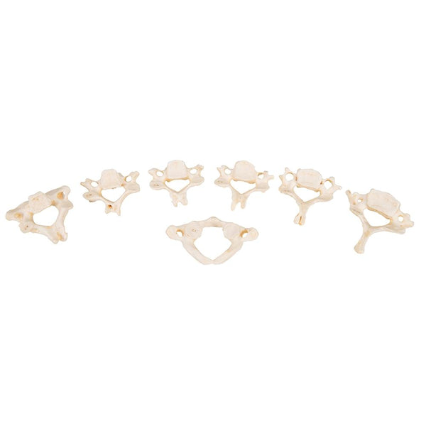 Set of 24 BONElike Vertebrae Models A793 – GTSimulators.com