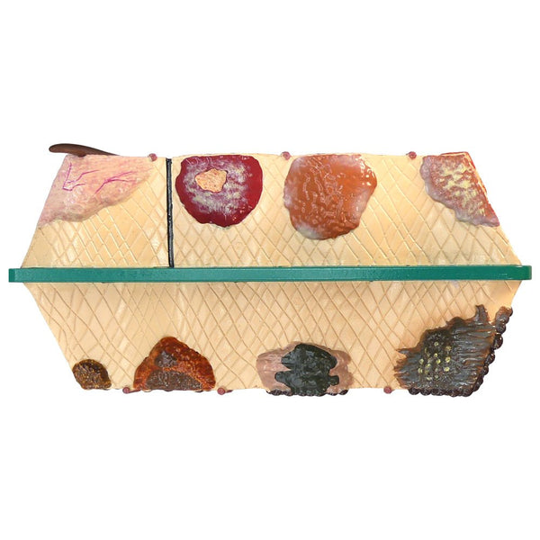 Skin Cancer Model – GTSimulators.com