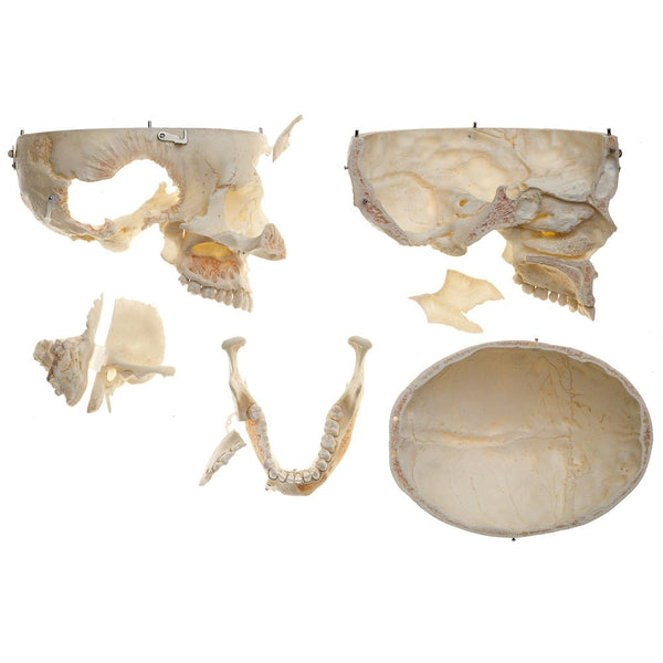 SOMSO Artificial Skull of an Adult - 10 parts – GTSimulators.com