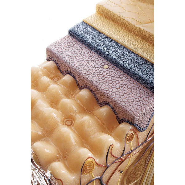 SOMSO Block Model of the Skin – GTSimulators.com