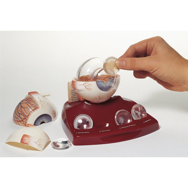SOMSO Cataract Eye Model – GTSimulators.com