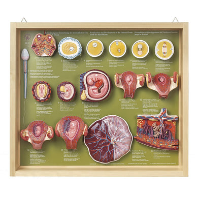 Somso Anatomy Models | Pregnancy Development Models – Tagged "Pregnancy ...
