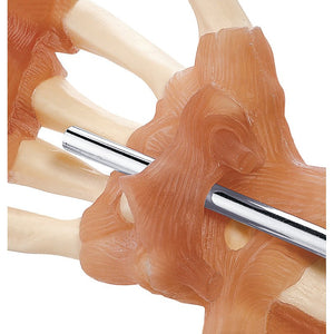 Somso Anatomy Models | Extremities and Joints Models – Tagged "Hand ...