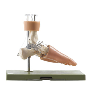 Somso Joint Models, Somso Functional Joint Models – Tagged "Foot ...
