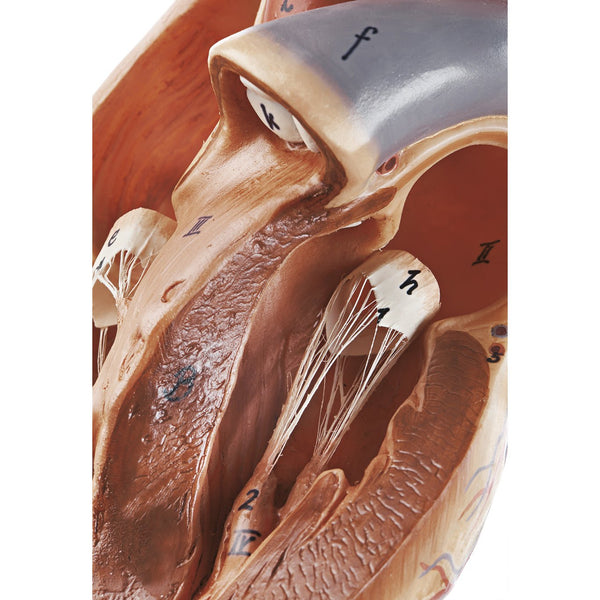 SOMSO Heart w- Bypass Vessels (Aortic Coronary Venous Bypass ...