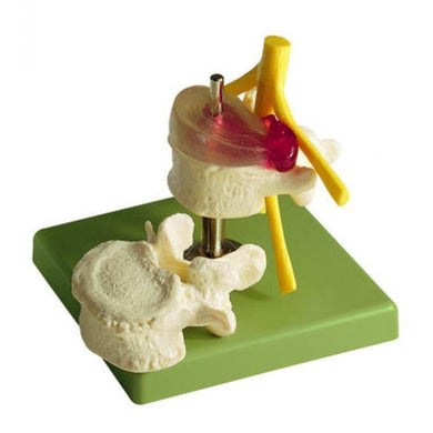 SOMSO Disc Models – Tagged "Artificial Bone Models" – GTSimulators.com