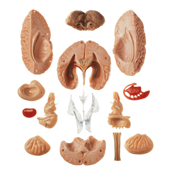 SOMSO Model of the Human Brain | SOMSO Human Brain Model – GTSimulators.com