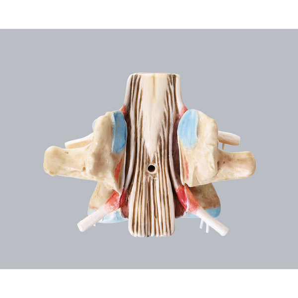 SOMSO Lumbar Vertebra (L-2) with Lumbar Region of Spinal Cord ...
