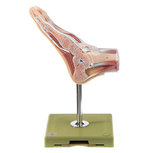 Somso Normal Foot Model With Surface Muscles Gtsimulators