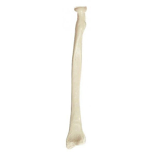 Radius Bone Diagram Unlabeled