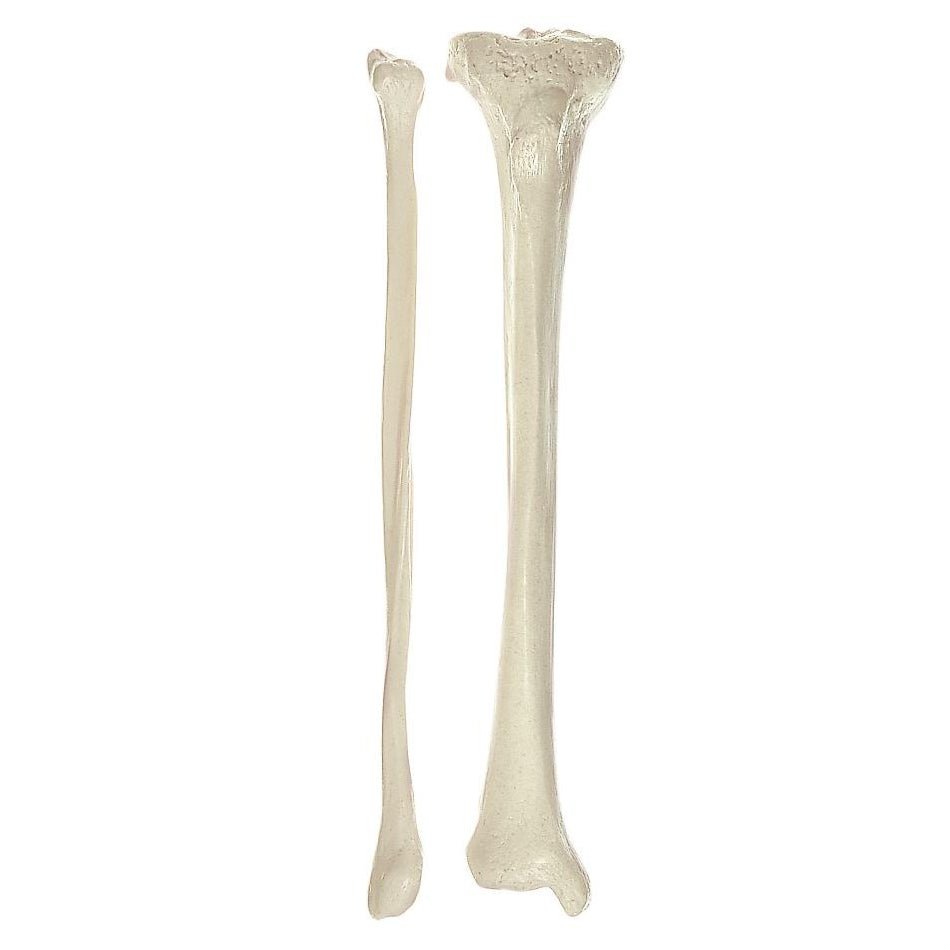 Blank Radius And Ulna Diagram