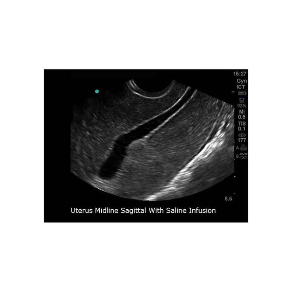 Sonohysterographay & Sonosalpingography Transvaginal Ultrasound Traini ...