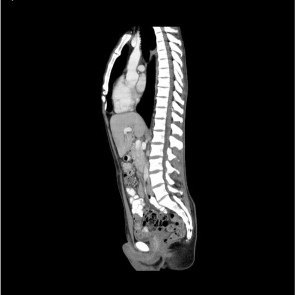 Portal Venous Phase Torso Phantom for CT Scan and X-Ray Training ...