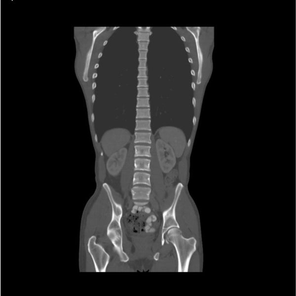 Portal Venous Phase Torso Phantom for CT Scan and X-Ray Training ...