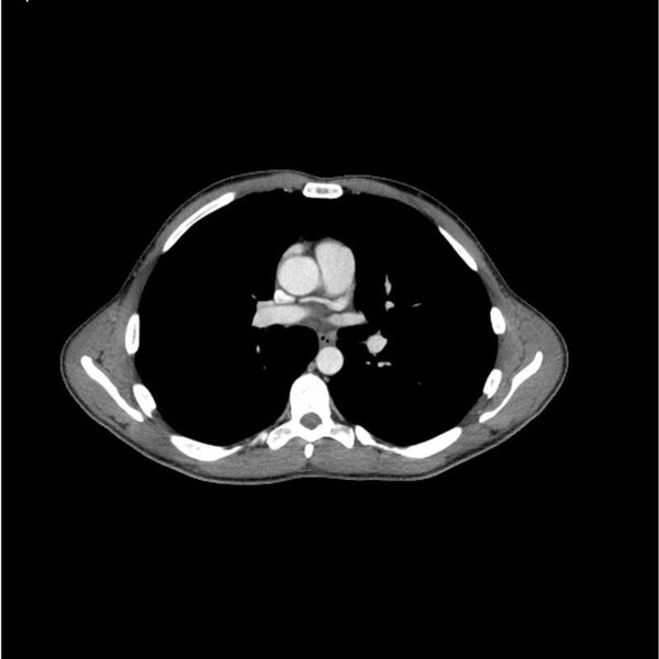 Portal Venous Phase Torso Phantom for CT Scan and X-Ray Training ...