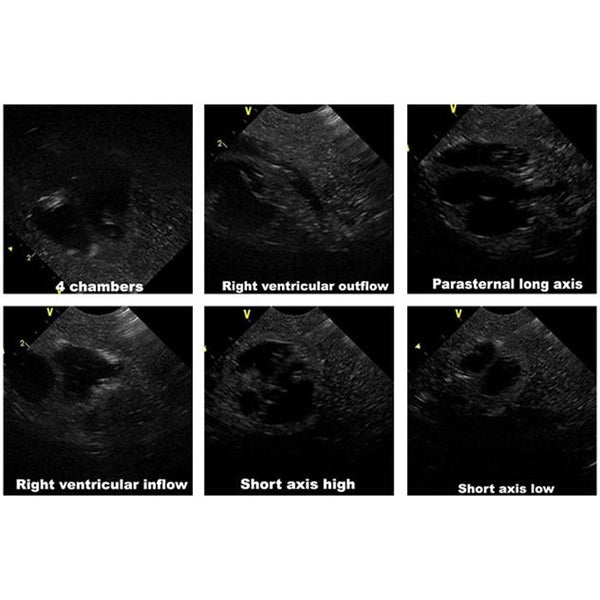 Transparent Newborn Torso for Ultrasound Training – GTSimulators.com