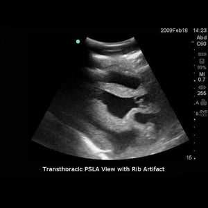 Blue Phantom Cardiology Ultrasound Training Models – Tagged "Resources ...