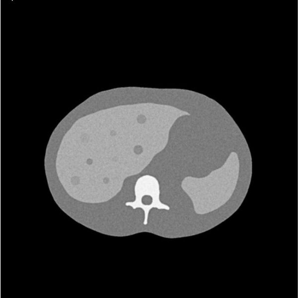 Low-Contrast Spheres Uniform Abdomen Phantom For CT Scan and X-Ray Tra ...