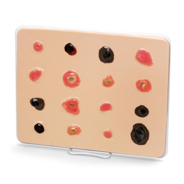 Life/form® White Skin Cancer Trainer - Enlarged LF00950U – GTSimulators.com