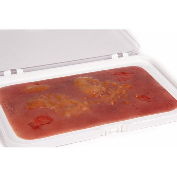 Wound Moulage 2nd Degree Burn Kit – GTSimulators.com