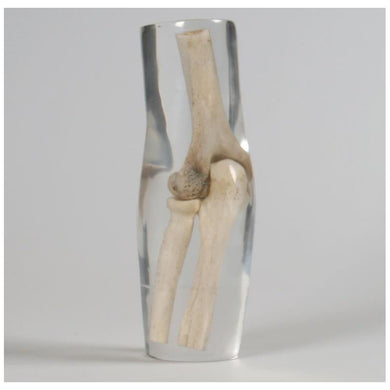 X-Ray Phantoms | Radiology Training Phantoms and Simulators ...